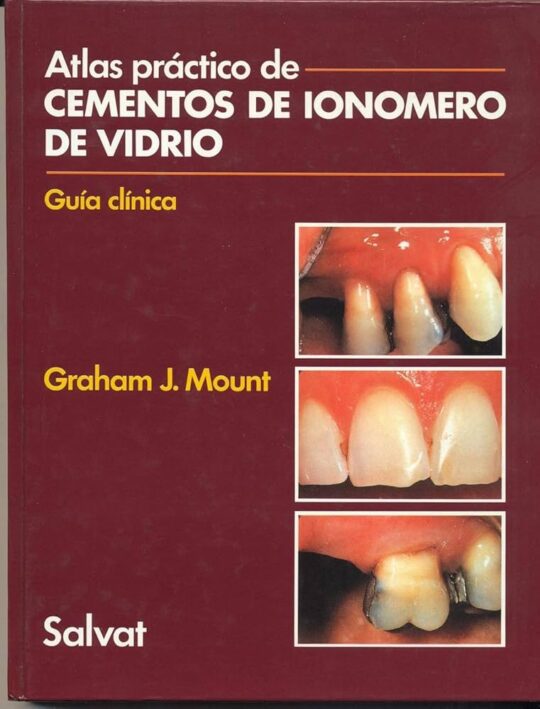 Atlas Practico de Cementos de Ionomero de Vidrio. Guia Clinica de ...